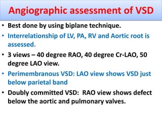 An approach to a patient with ventricular septal defect | PPSX