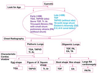 An approach to a patient with ventricular septal defect | PPSX