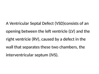 Ventricular septal defect Ppt presentation | PPTX