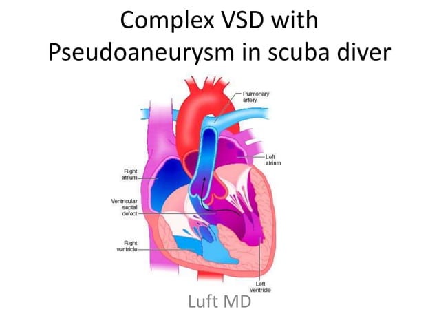 Complex VSD closure with Pseudoaneurysm and PFO | PPT