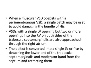 Vsd surgery | PPTX