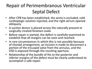 Vsd surgery | PPTX