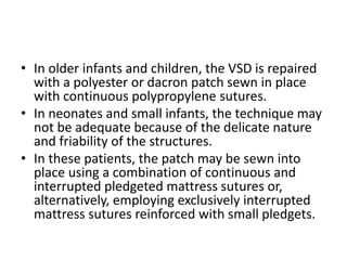Vsd surgery | PPTX