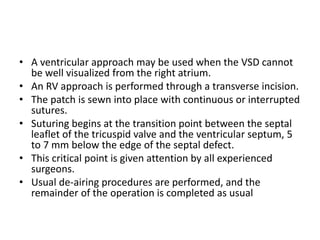 Vsd surgery | PPTX