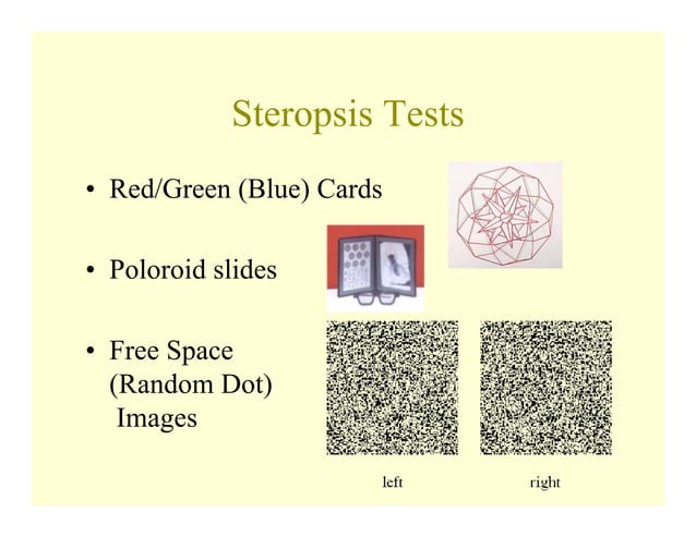 Vision Science in Optometry | PDF | Eye and Vision Conditions | Diseases and Conditions