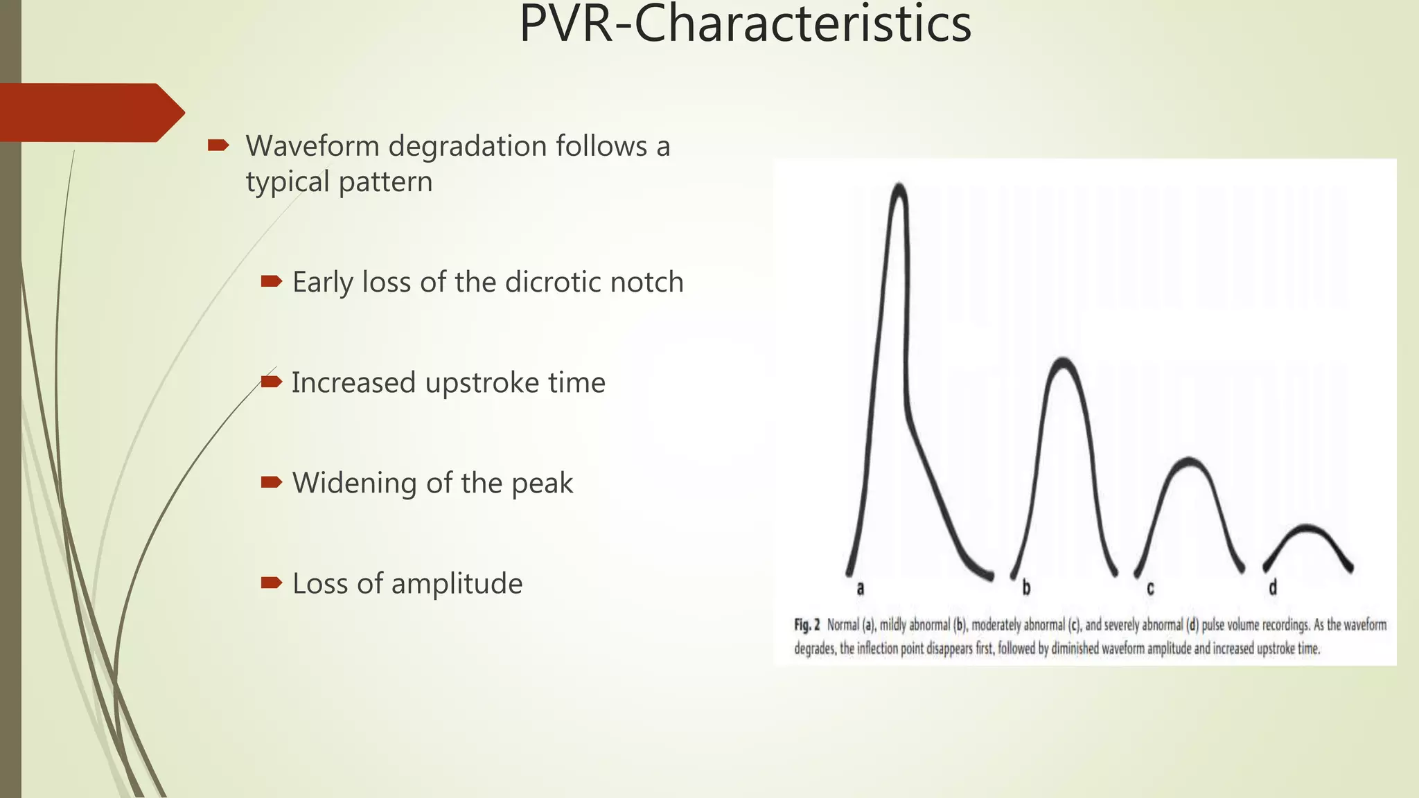 Vascular Laboratory: Arterial Physiologic Assessment & Arterial Duplex ...