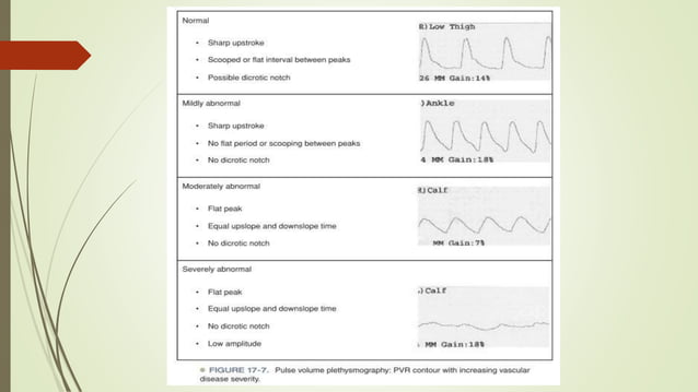 Vascular Laboratory: Arterial Physiologic Assessment & Arterial Duplex ...