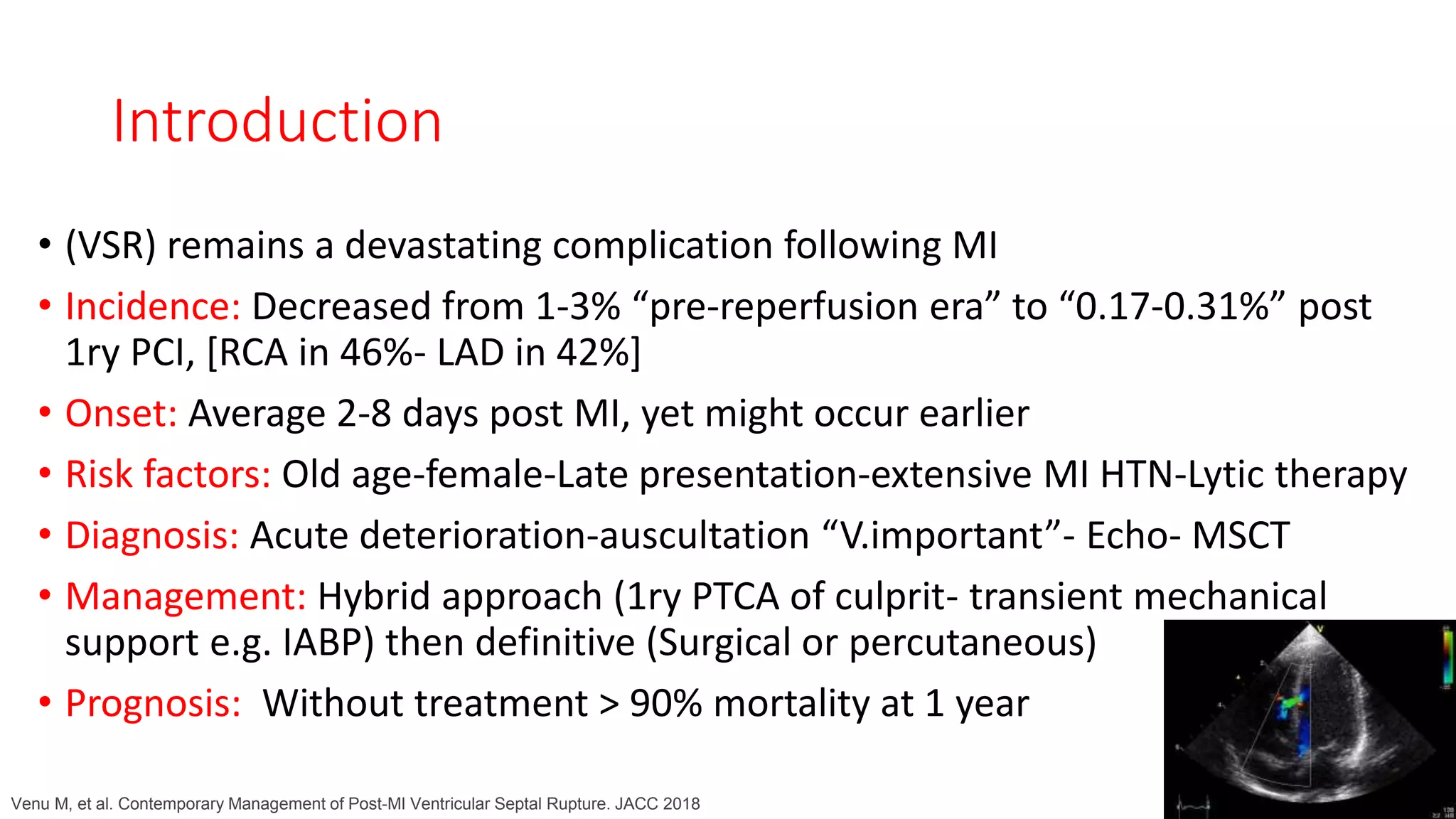 Ventricular septal rupture .pptx