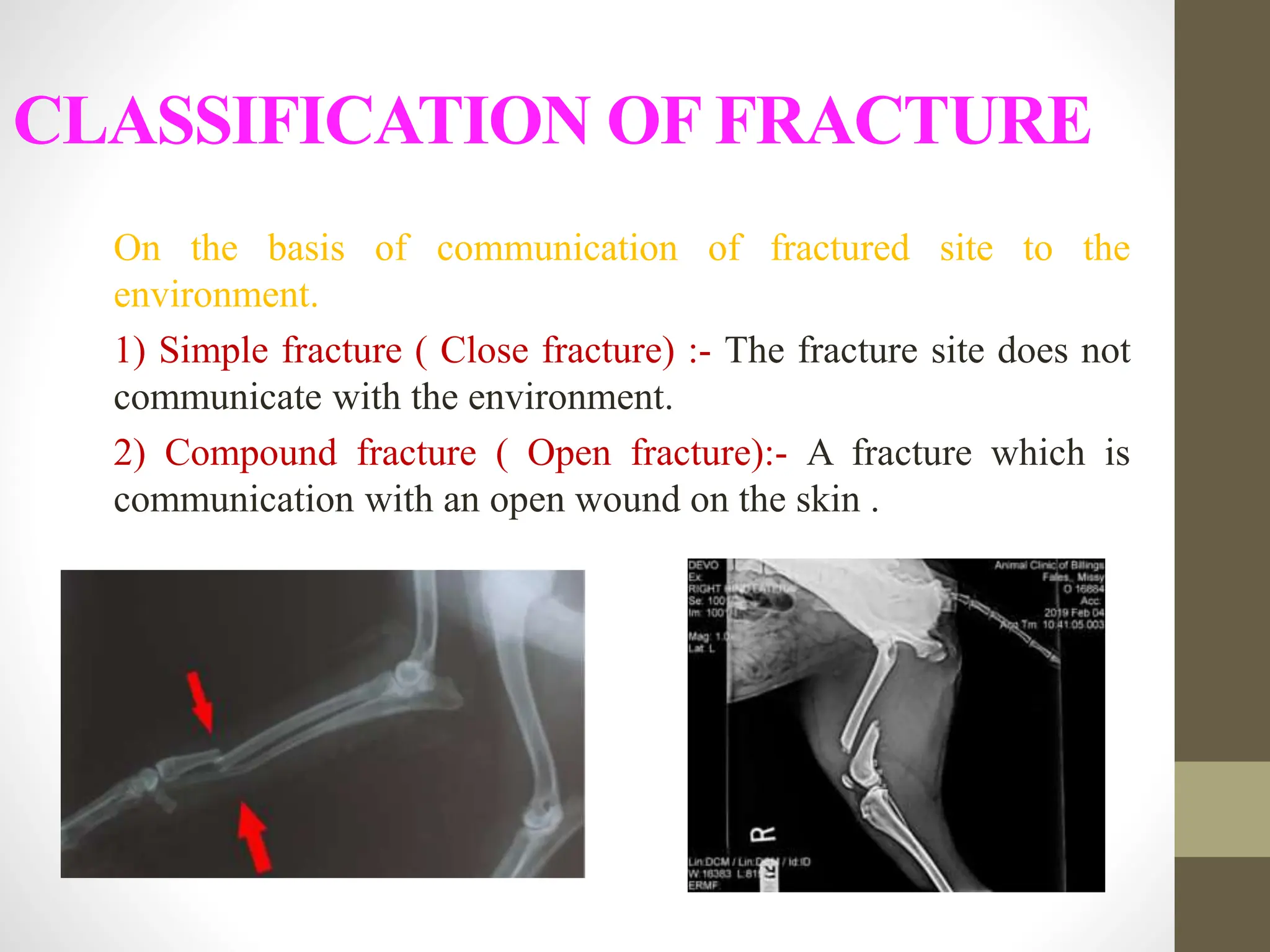 VSR610_PPT_Fracture.pptx classification of fractures | PPTX