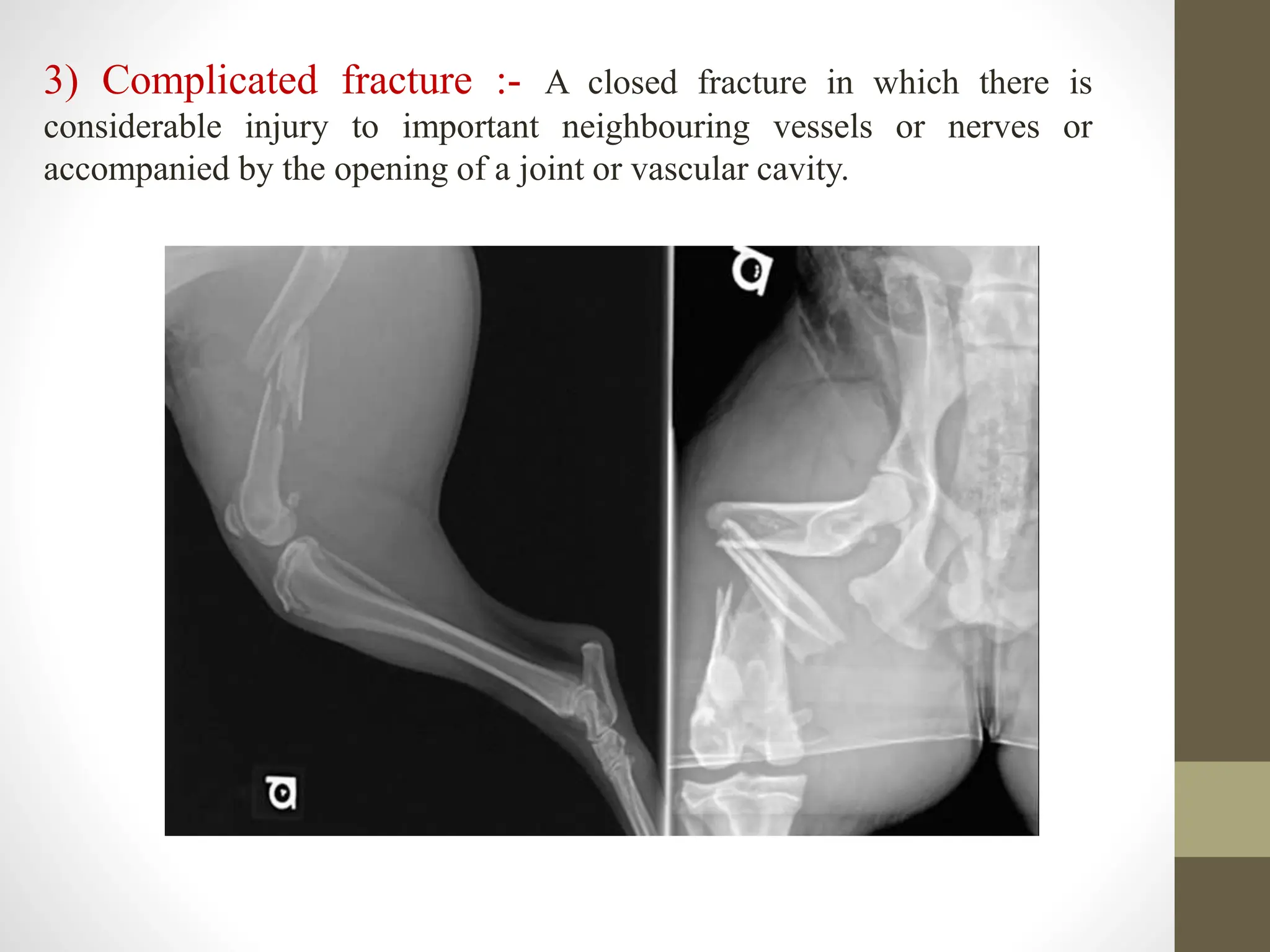 VSR610_PPT_Fracture.pptx classification of fractures | PPTX