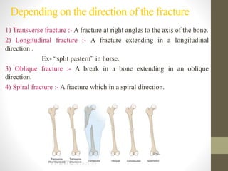 VSR610_PPT_Fracture.pptx classification of fractures | PPTX