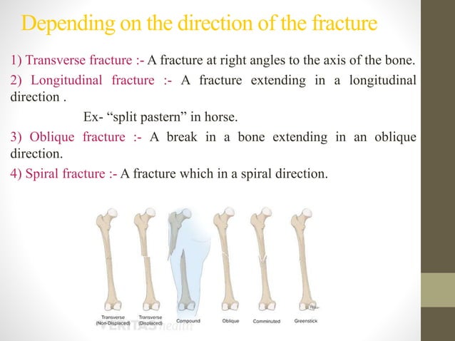 VSR610_PPT_Fracture.pptx classification of fractures | PPTX