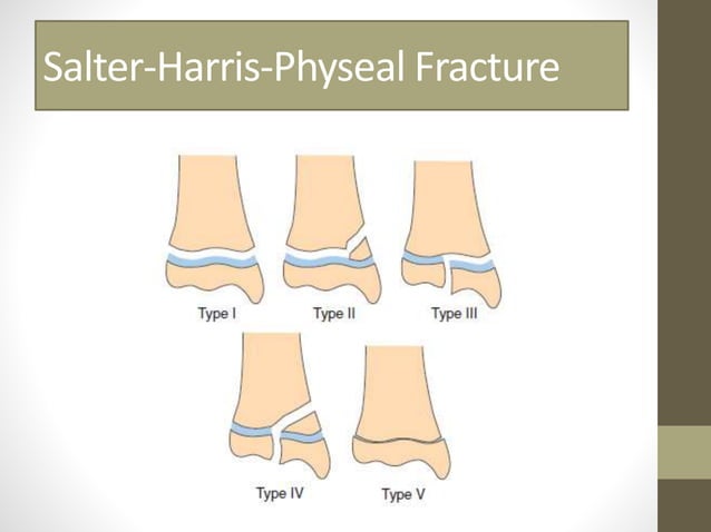 VSR610_PPT_Fracture.pptx classification of fractures | PPTX