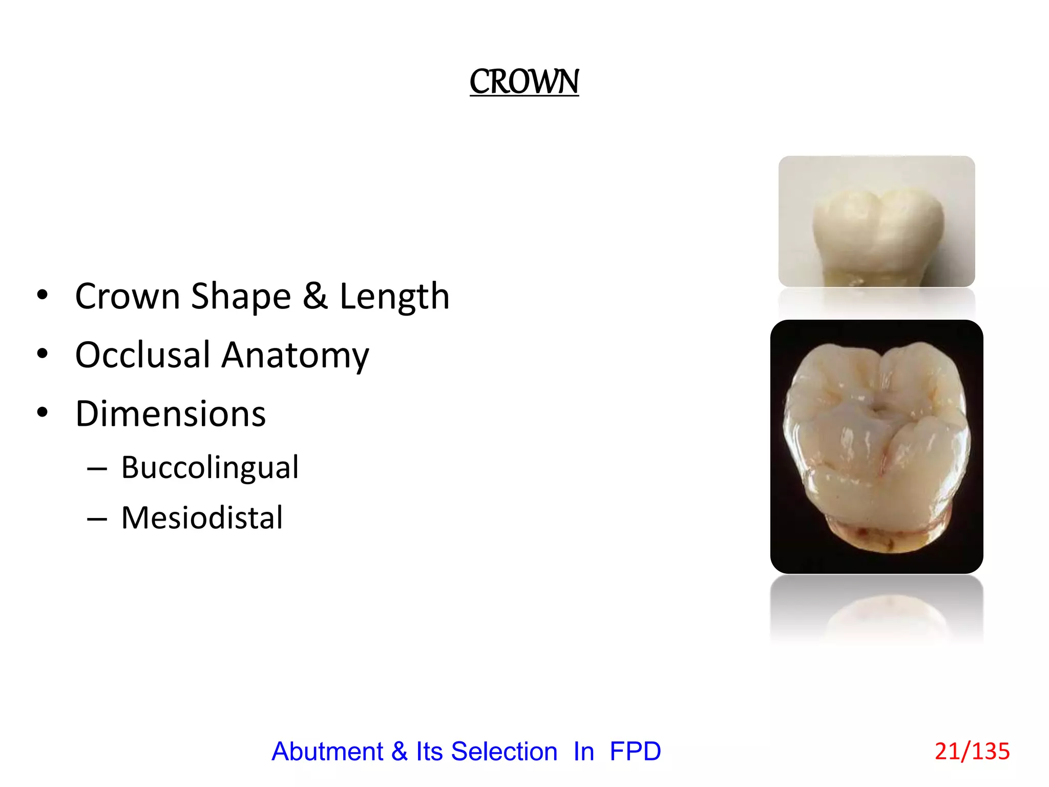 Abutment & Its Selection In Fixed Partial Denture | PPTX