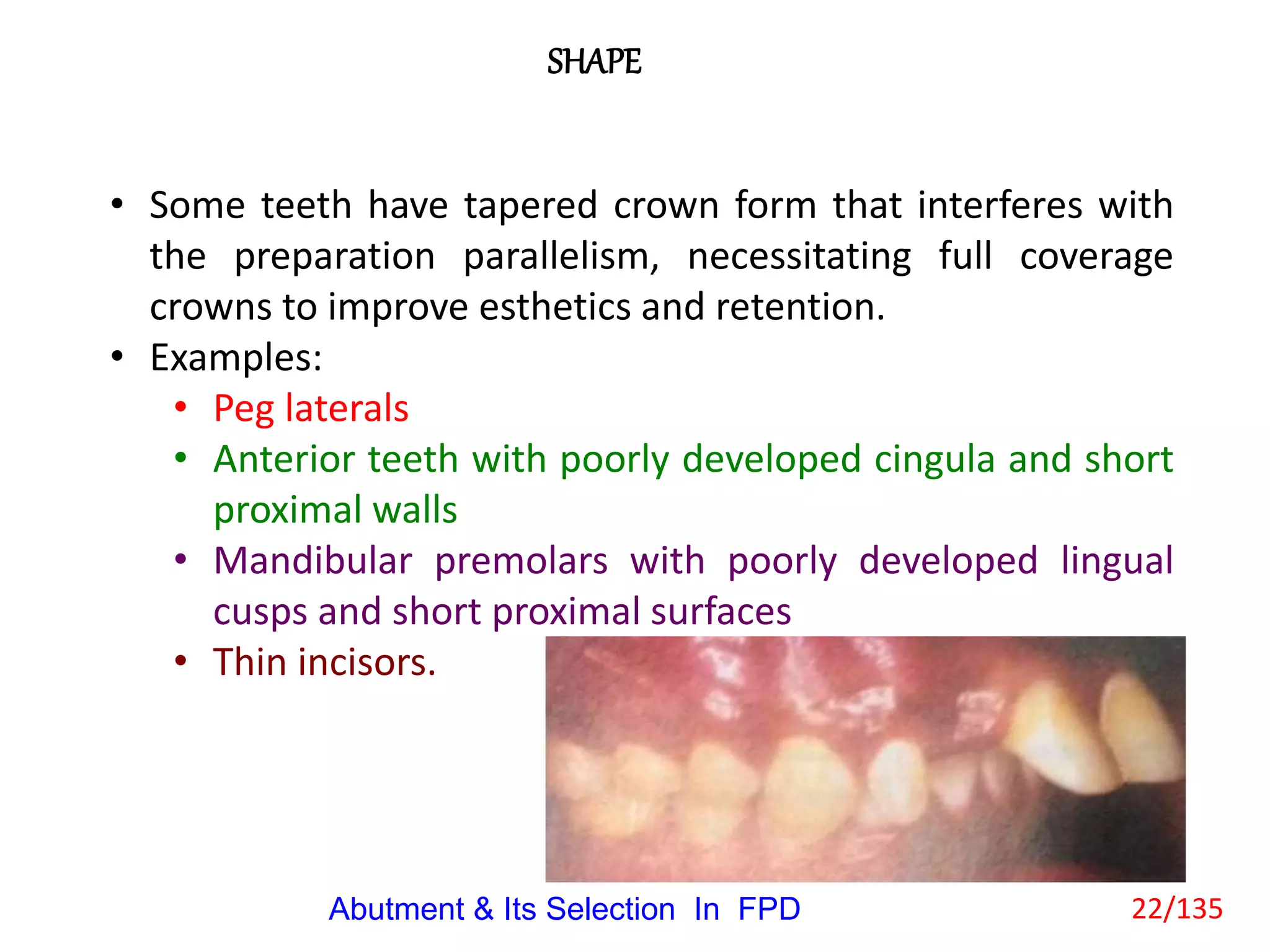 Abutment & Its Selection In Fixed Partial Denture | PPTX
