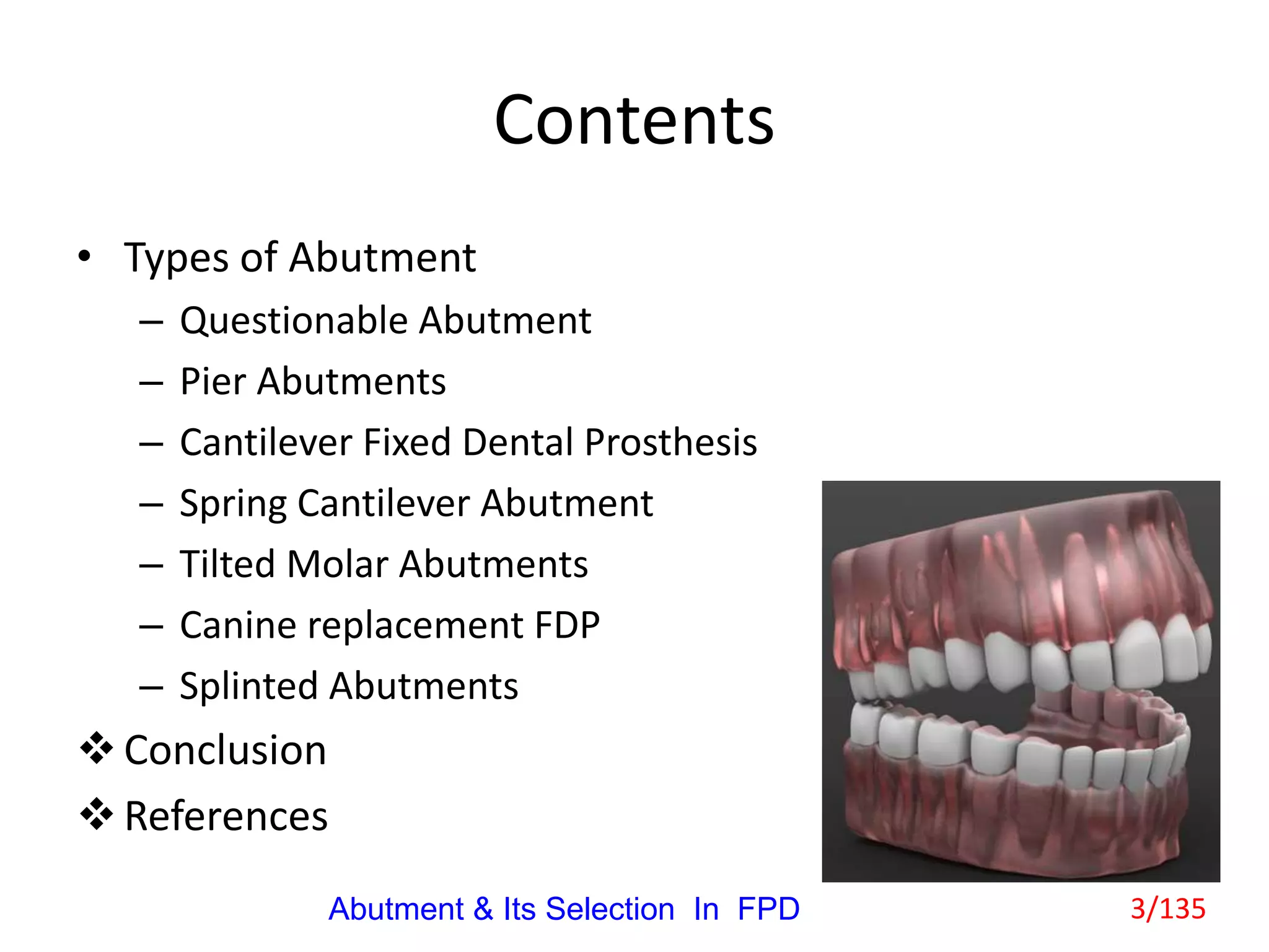 Abutment & Its Selection In Fixed Partial Denture | PPTX