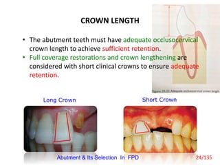 Abutment & Its Selection In Fixed Partial Denture | PPTX