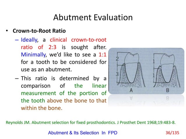 Abutment & Its Selection In Fixed Partial Denture | PPTX