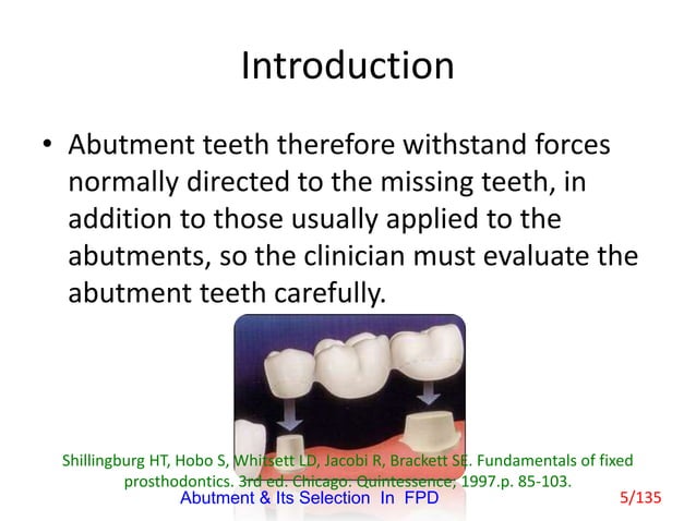 Abutment & Its Selection In Fixed Partial Denture | PPTX