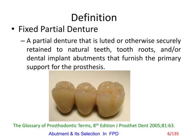 Abutment & Its Selection In Fixed Partial Denture | PPTX