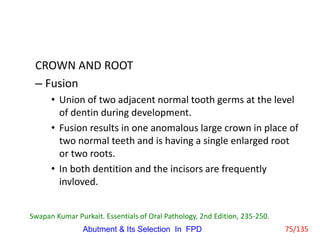 Abutment & Its Selection In Fixed Partial Denture | PPTX