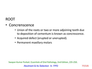 Abutment & Its Selection In Fixed Partial Denture | PPTX