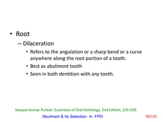 Abutment & Its Selection In Fixed Partial Denture | PPTX