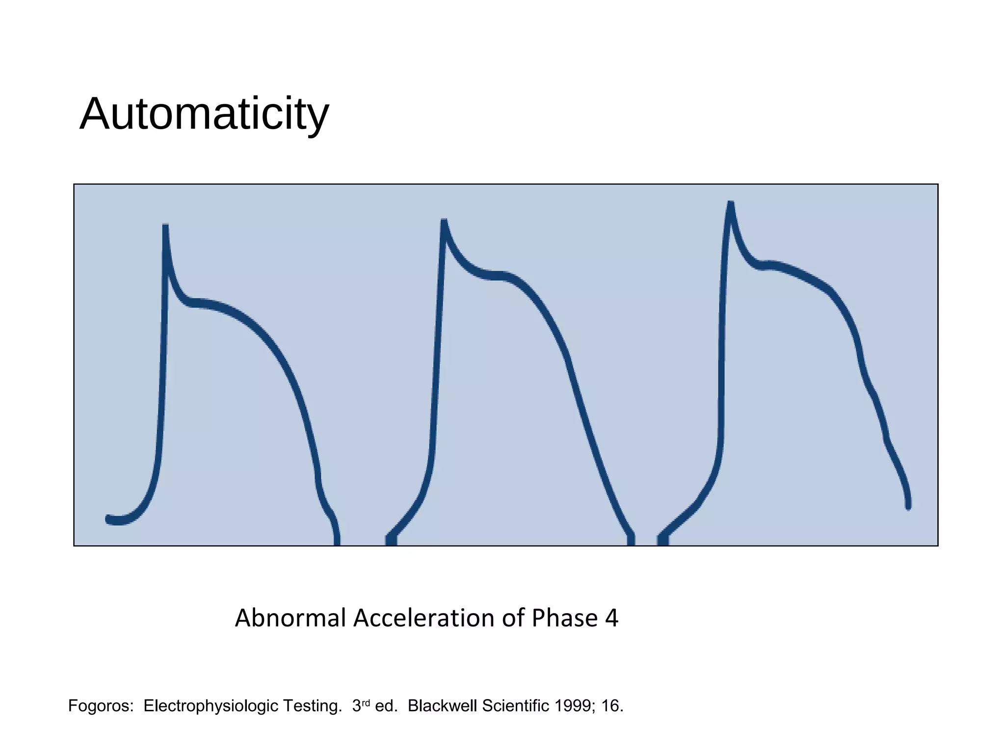 Ventricular arrhythmias | PPT