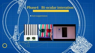 Vision Therapy | PPTX