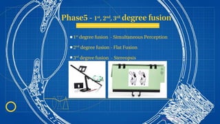 Vision Therapy | PPTX