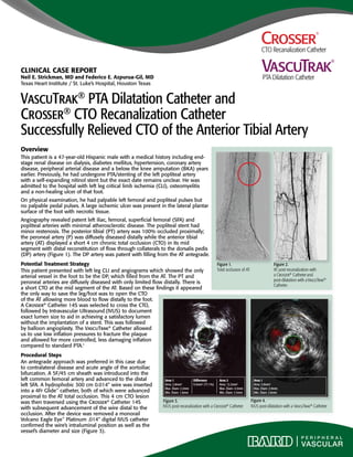 Vt crosser-clinical-case-study | PDF