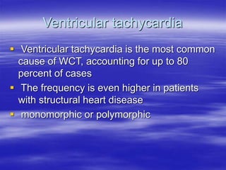 VT-diagnosis.ppt