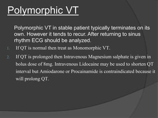 Ventricular tachycardia by dr.muzahid | PPTX | Heart and Cardiovascular ...