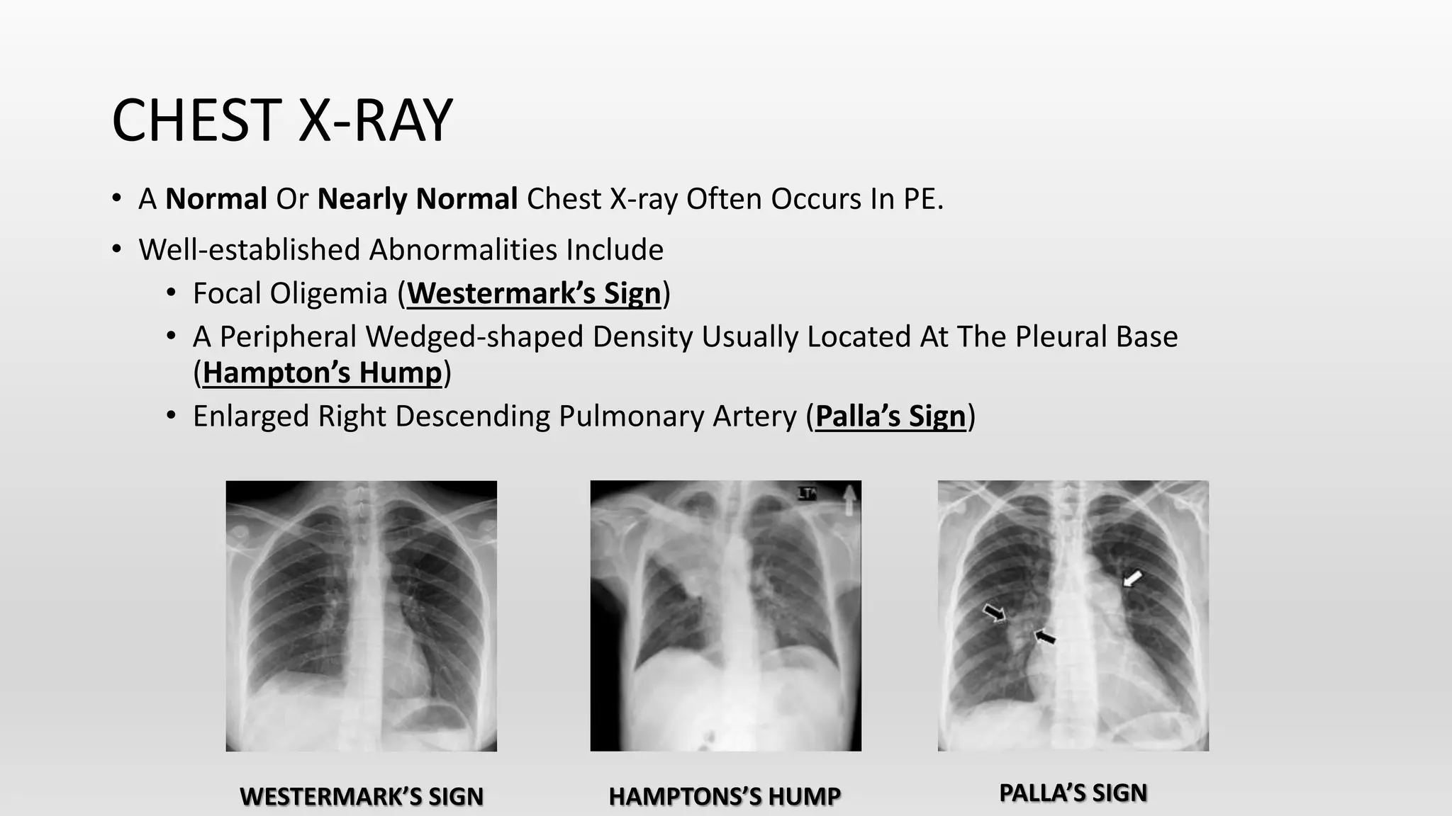 Pulmonary and venous thromboembolism.pptx