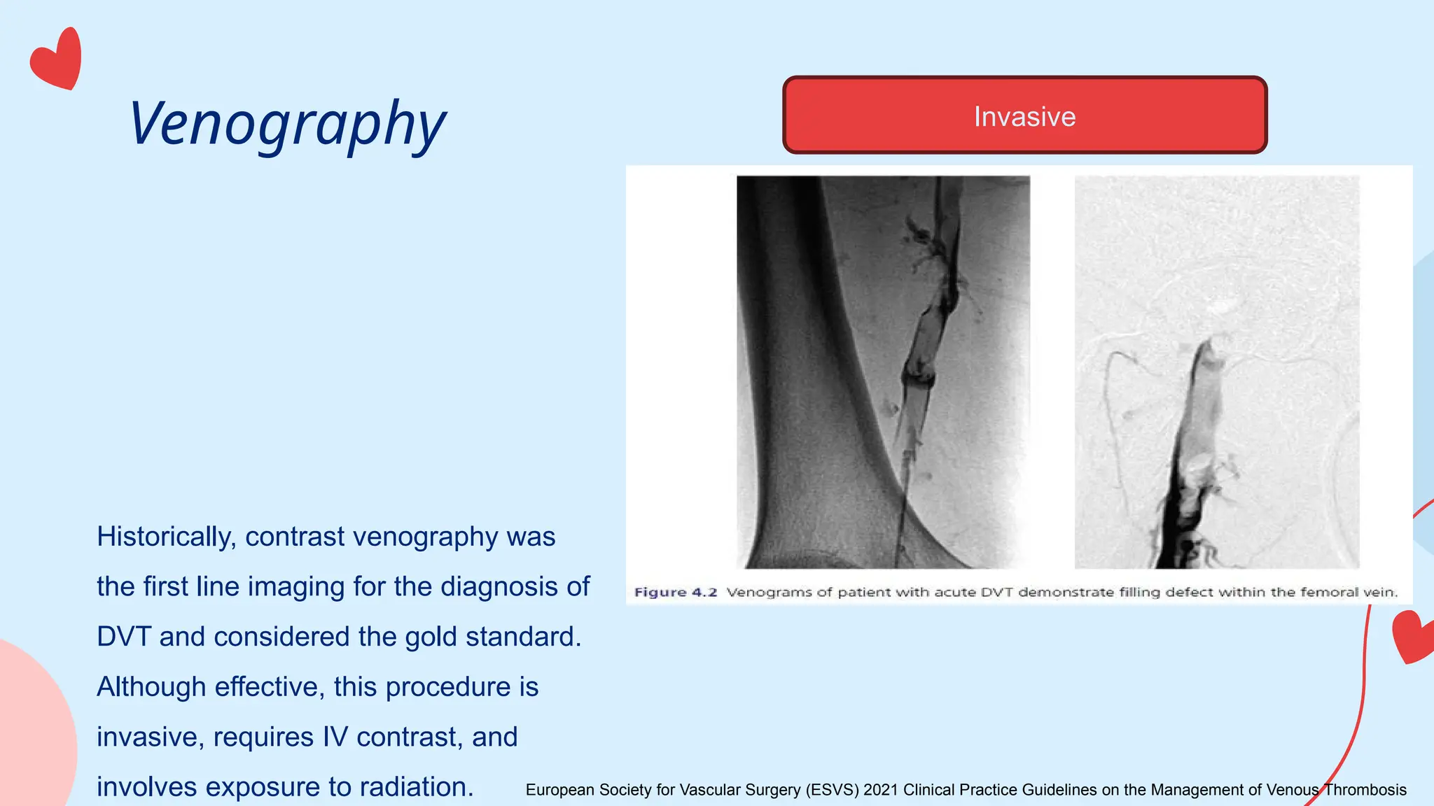 VTE-DVT-PE explanation etiology patophysiology.pptx