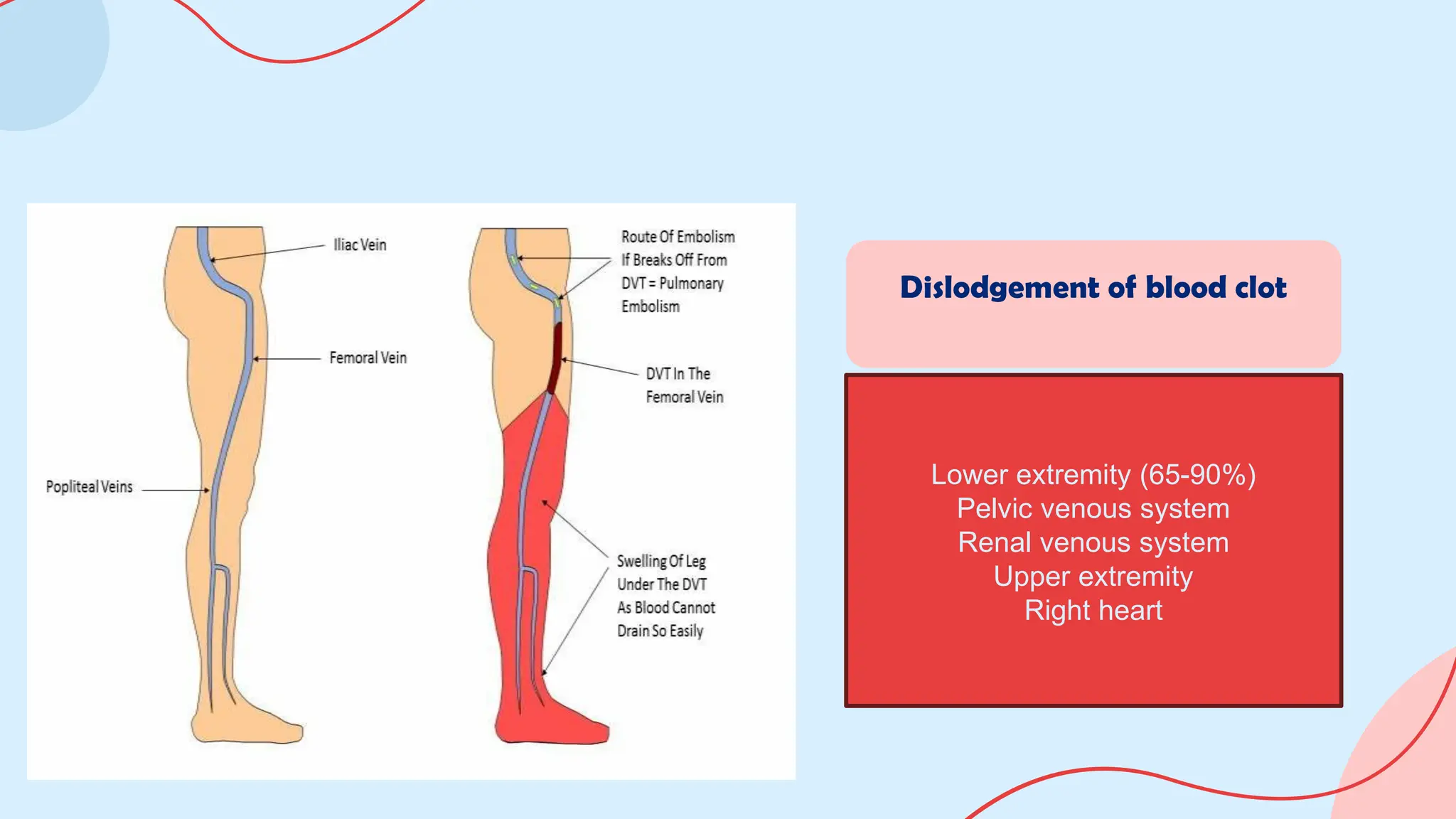 VTE-DVT-PE explanation etiology patophysiology.pptx