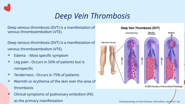 VTE-DVT-PE explanation etiology patophysiology.pptx