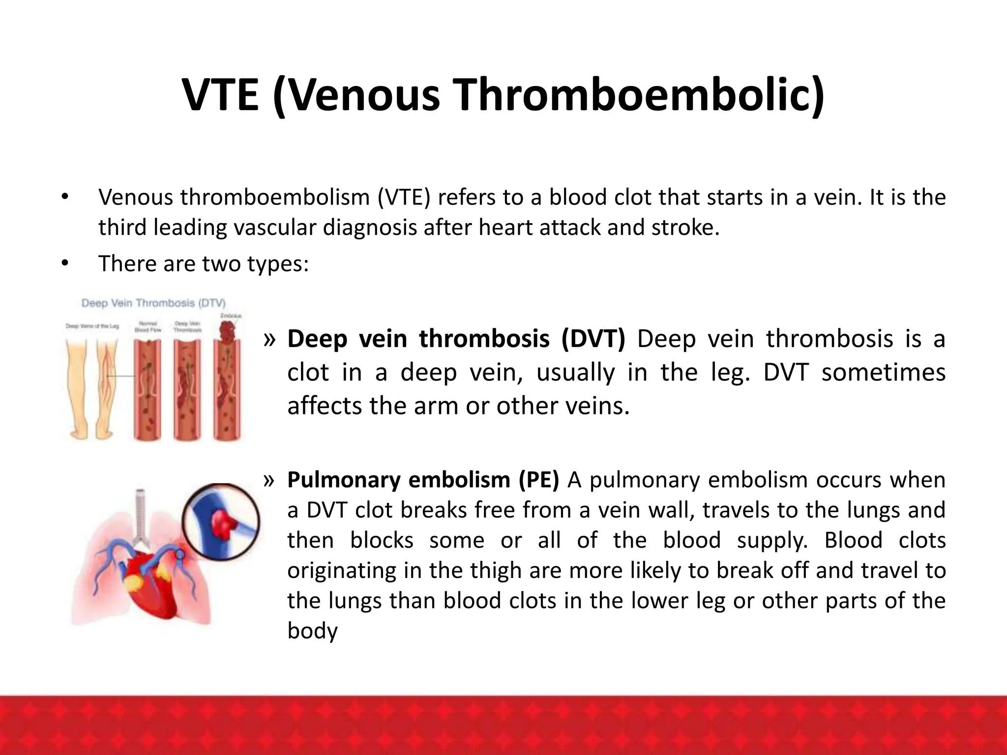 VTE assessment and prophylaxis.ppt