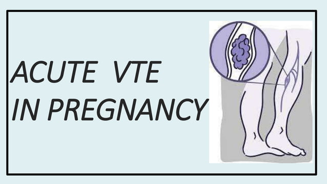 VTE IN PREGNANCY.pptx