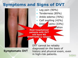 VTE prophylaxis simplified focus on prevention.ppt