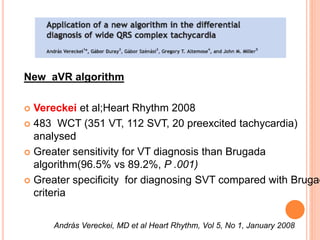 VT in structurally normal heart | PPTX