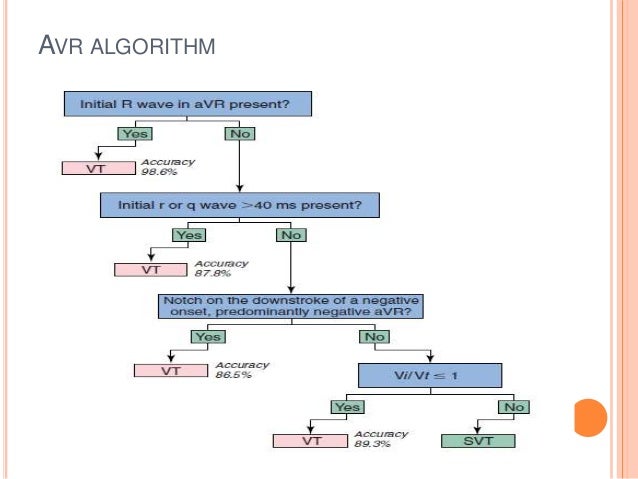 VT in structurally normal heart
