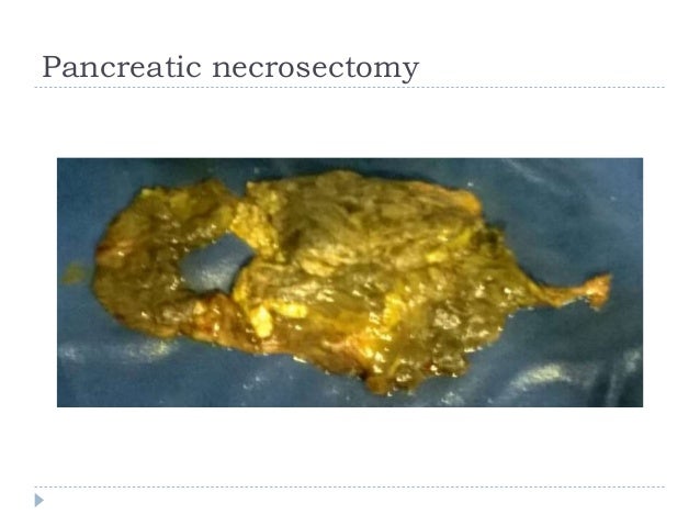 Necrotizing pancreatitis