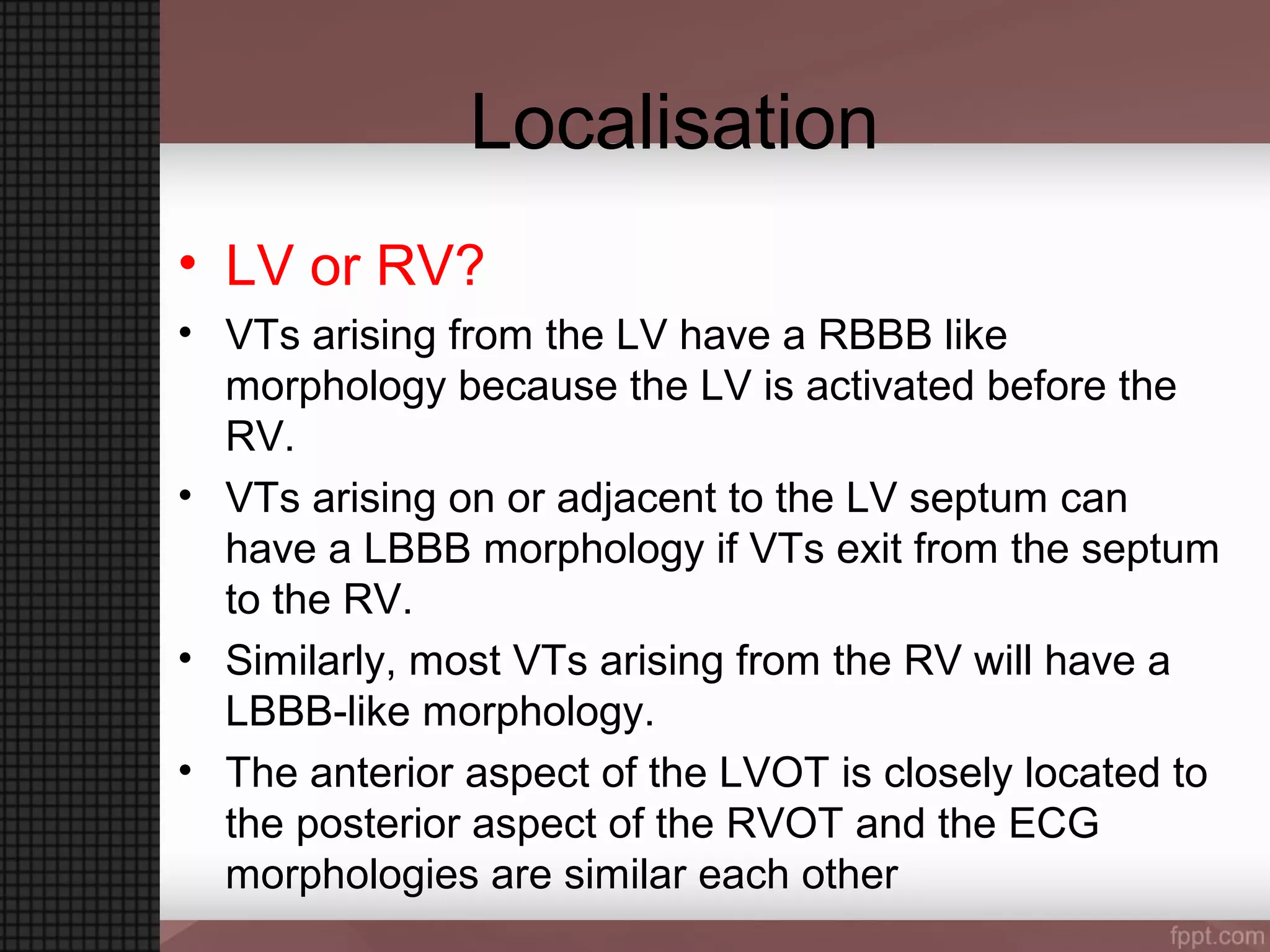 ventricular tachycardia (VT) Localisation | PPT
