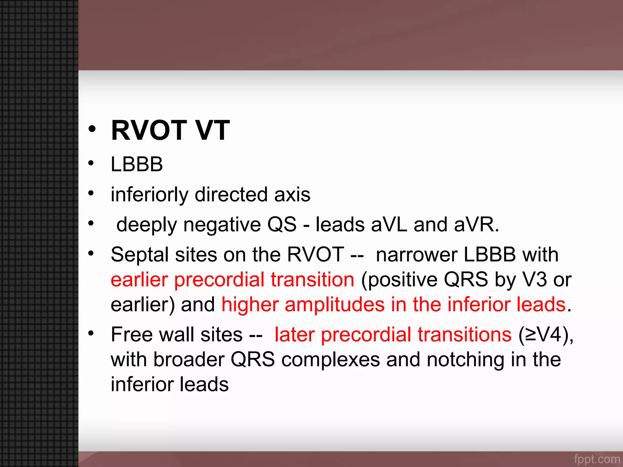 ventricular tachycardia (VT) Localisation | PPT