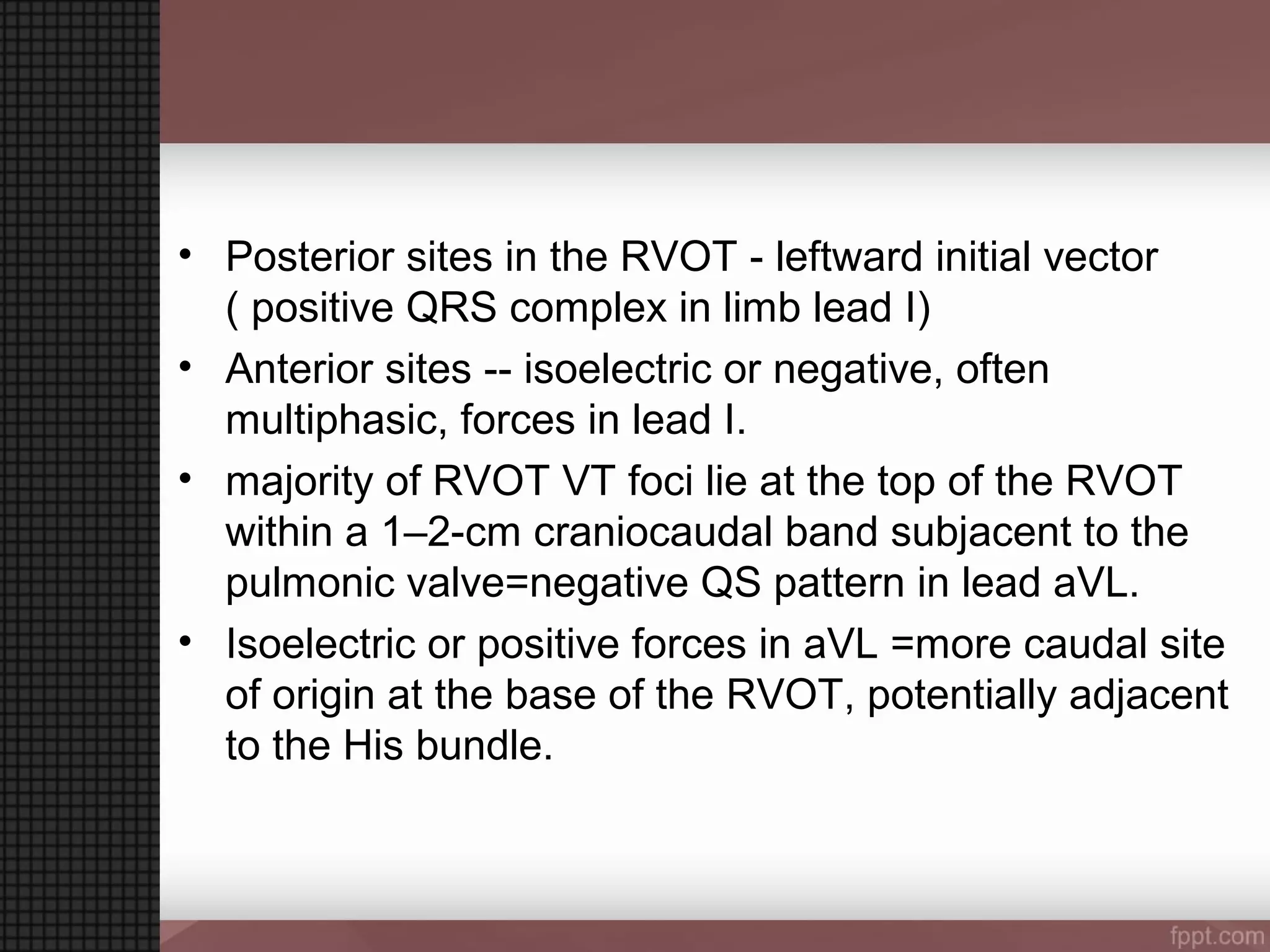ventricular tachycardia (VT) Localisation | PPT