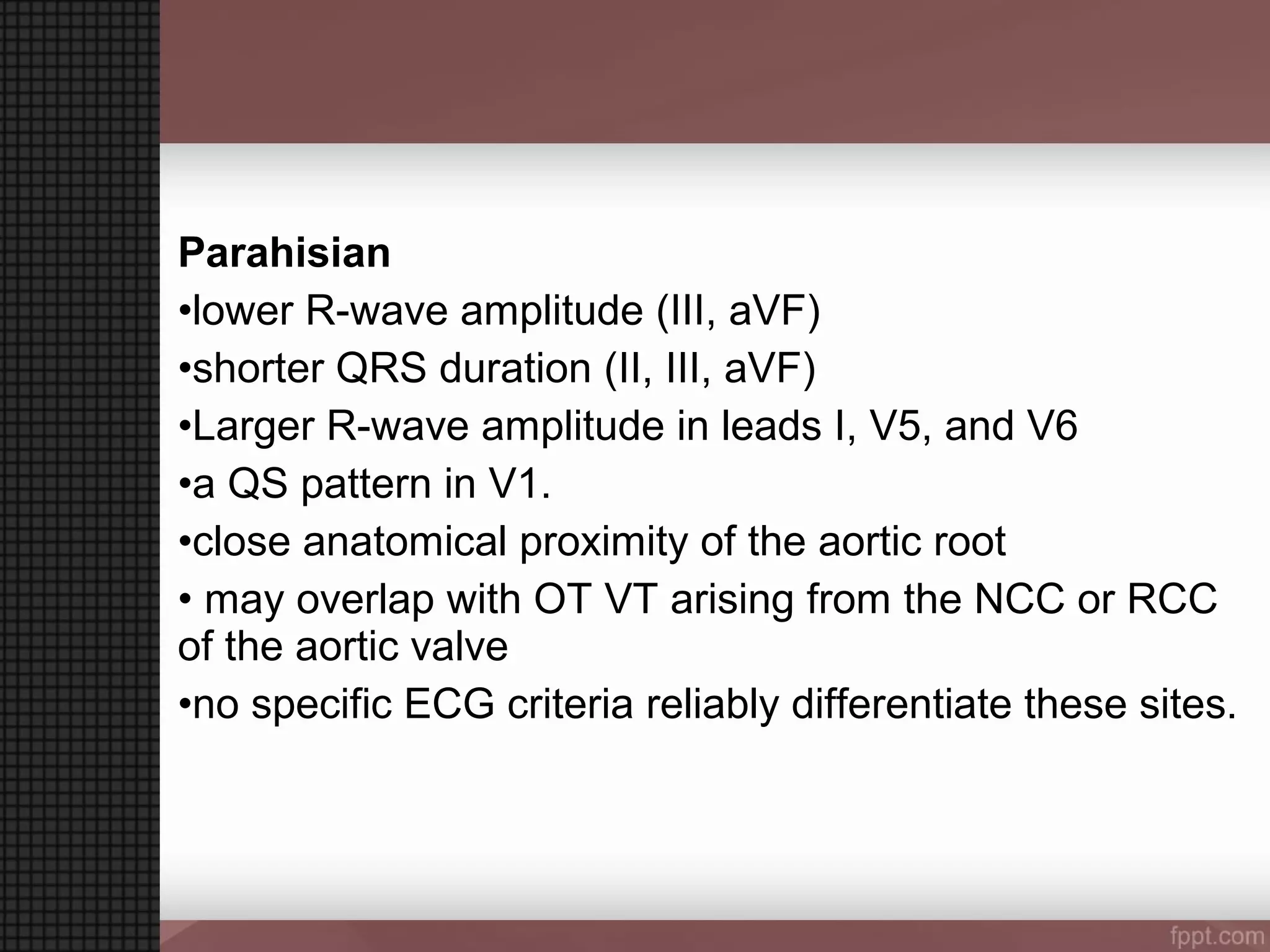ventricular tachycardia (VT) Localisation | PPT