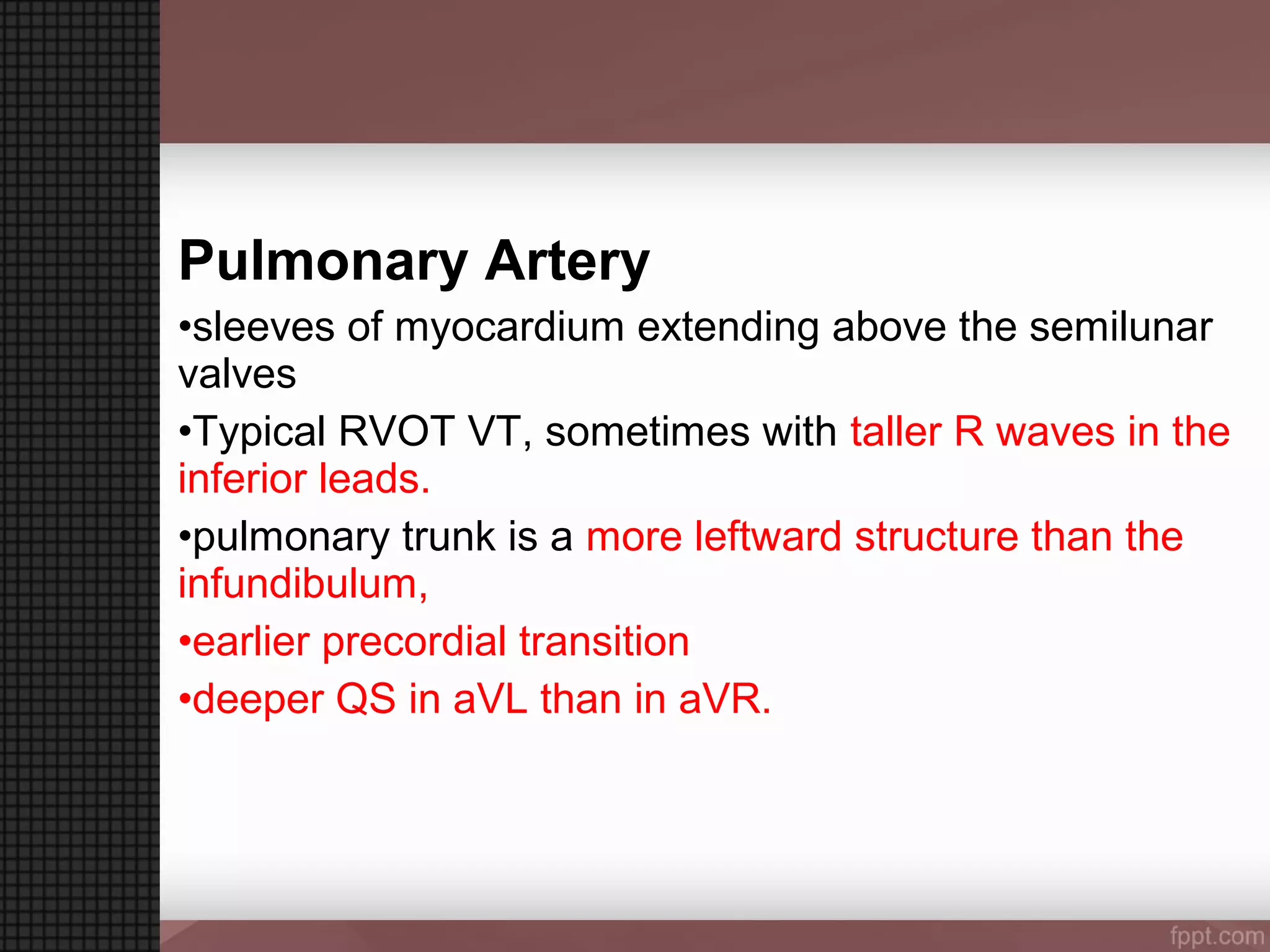 ventricular tachycardia (VT) Localisation | PPT