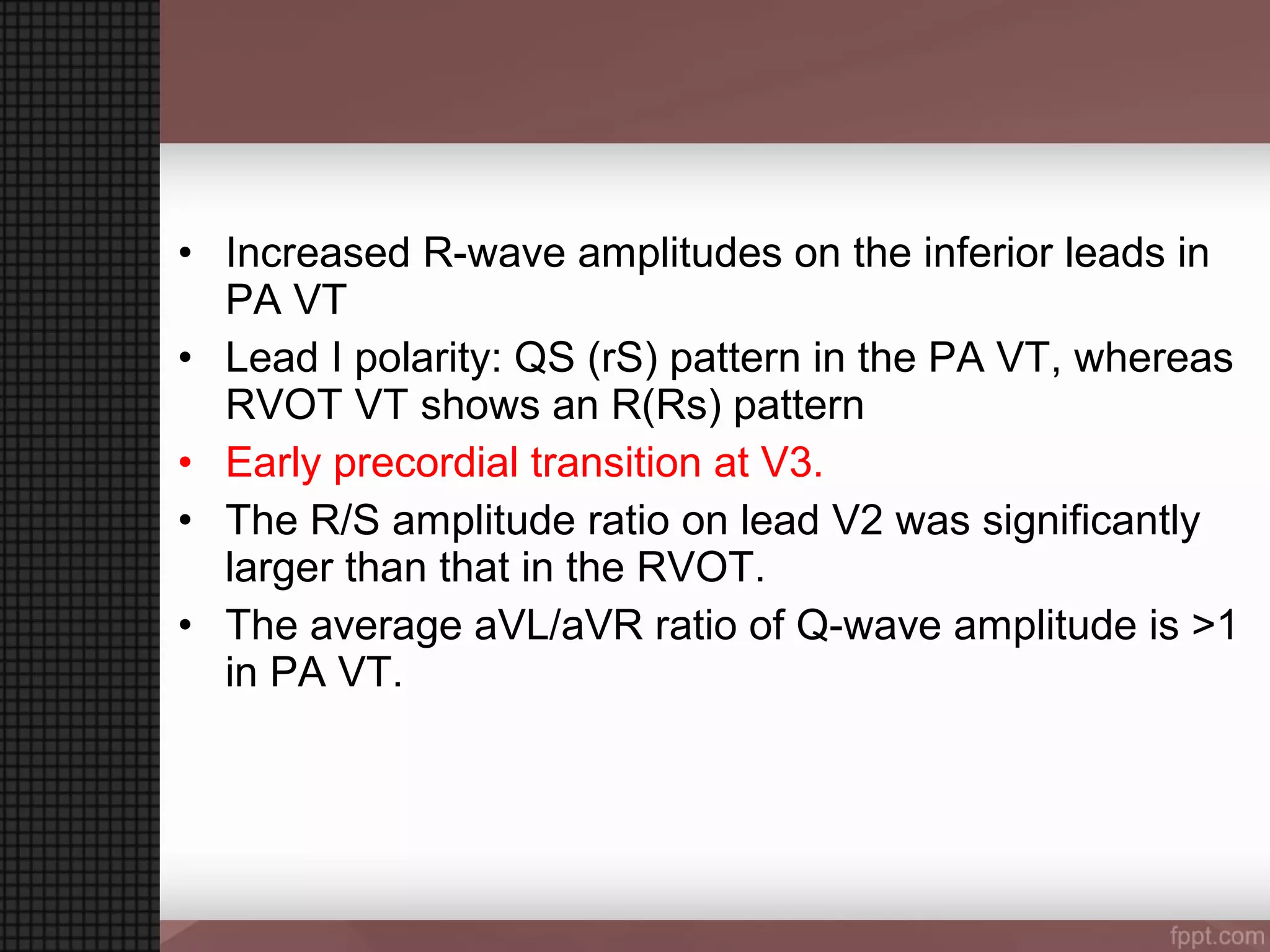 ventricular tachycardia (VT) Localisation | PPT