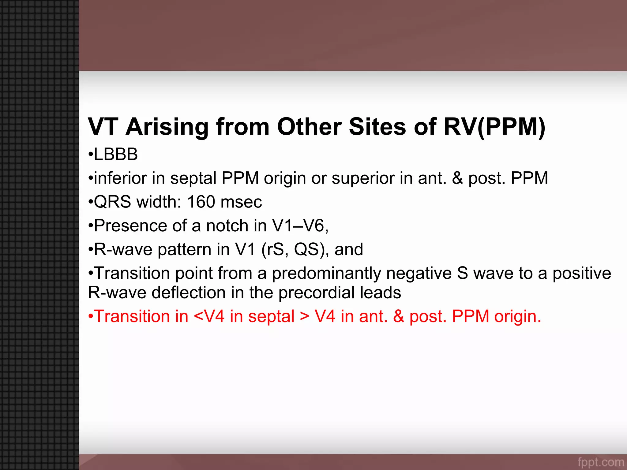 ventricular tachycardia (VT) Localisation | PPT